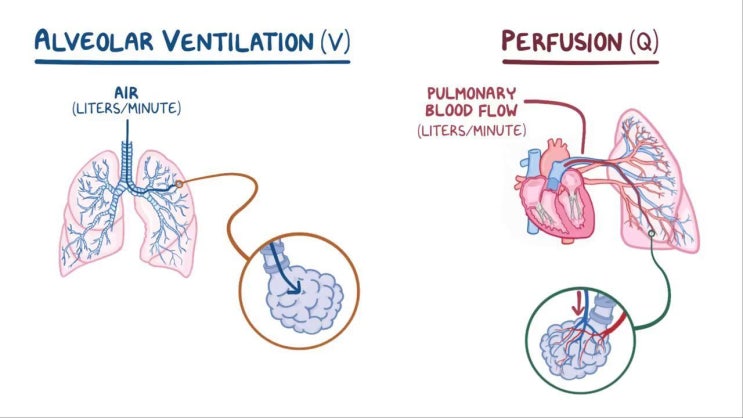 [Why nursing 001 ] Good/bad lung down position : 네이버 블로그