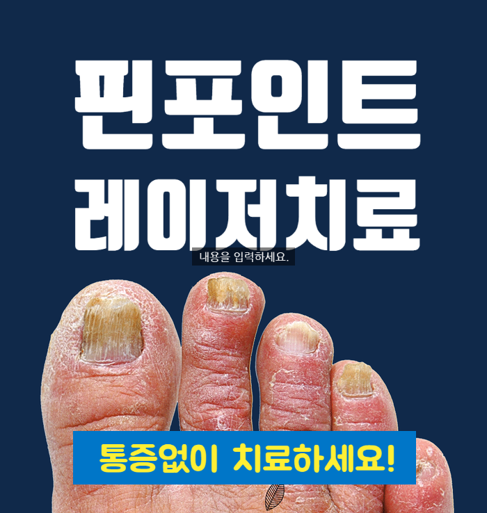 용인 수지 발톱 무좀 레이저치료실비보험으로 부담 없이 받으세요 네이버 블로그