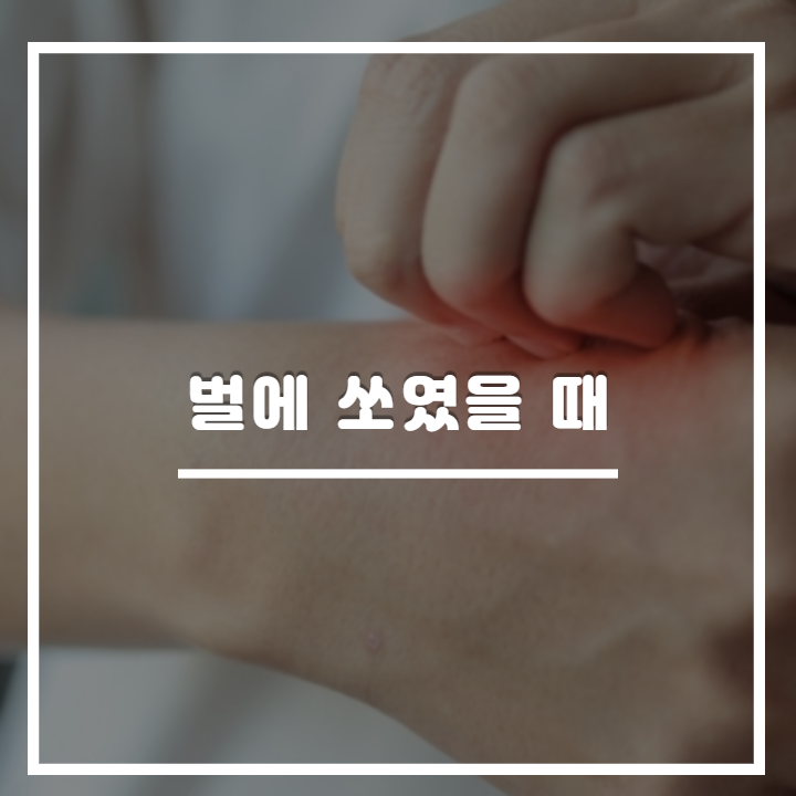 벌에 쏘였을때 즉시 취할 수 있는 응급처치 2가지 바르는 연고 먹는 약 네이버 블로그