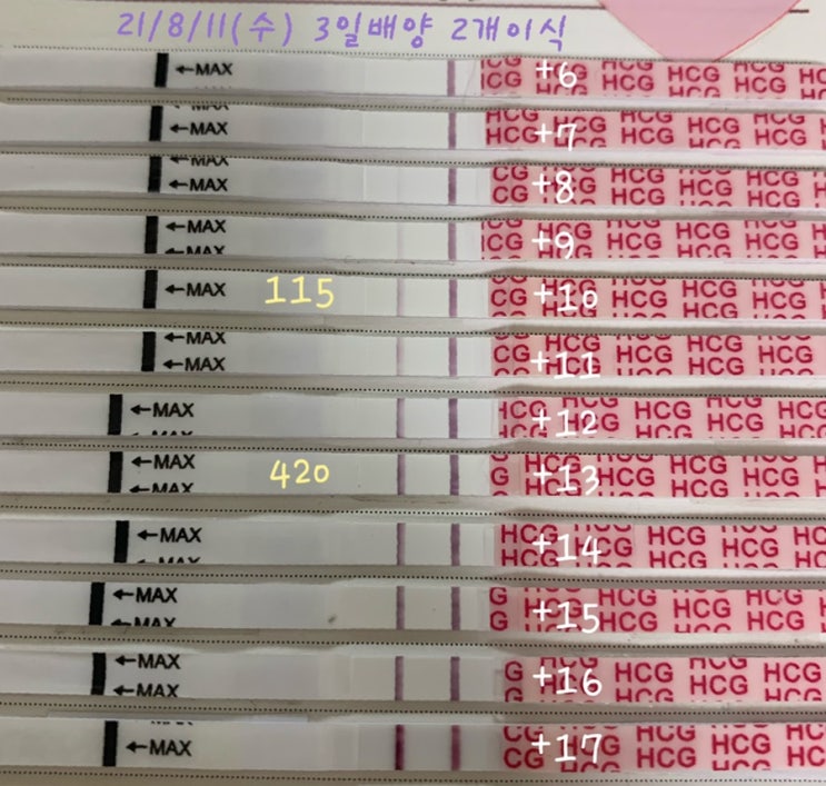 3일배양6일째~17일째임테기3일배양임테기원포임테기임테기정리임테기정체기3일배양피검3일배양피검수치3일배양원포임테기3일