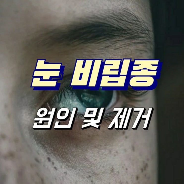 눈밑 비립종 원인 눈 비립종 제거 방법 눈꺼풀 좁쌀 여드름 네이버 블로그