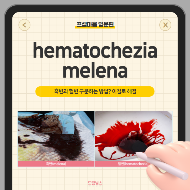 hematochezia melena 어떻게 구분하나요? 간호 처치까지 : 네이버 블로그
