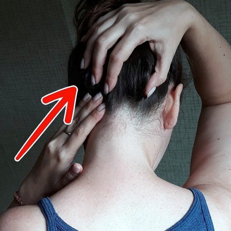 머리 귀뒤쪽 통증 뒷목 찌릿 두통심할때 머리가 아파요 네이버 블로그