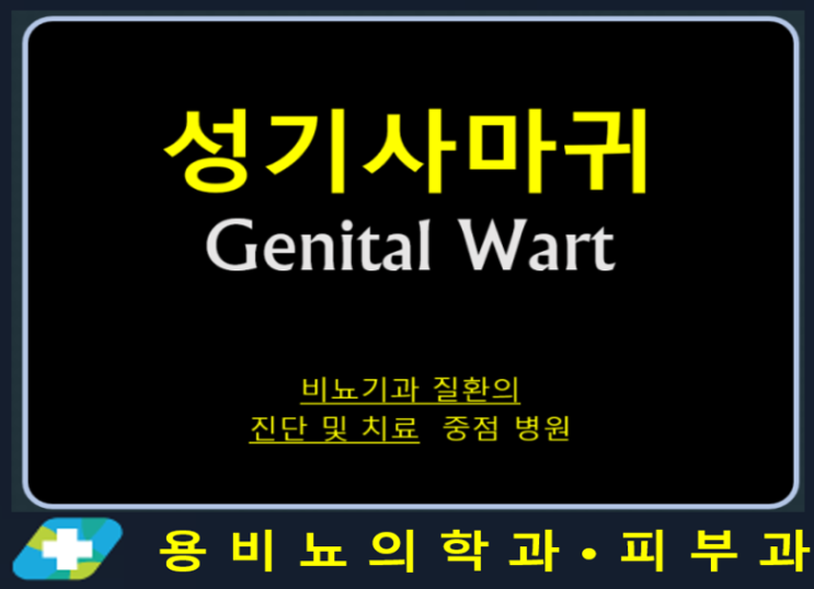 전주성병 곤지름 성기사마귀 첨큐콘딜로마 원인 및 예방 제거 네이버 블로그