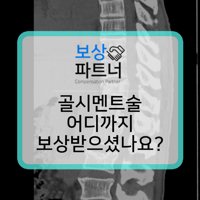 T11 kyphoplasty L2 vertebroplasty 골시멘트술 후유장해 보상까지 받으셨나요? : 네이버 블로그