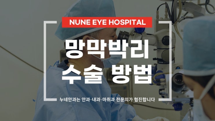 망막박리 수술 방법 공막돌륭술 Vs 유리체절제술 네이버 블로그