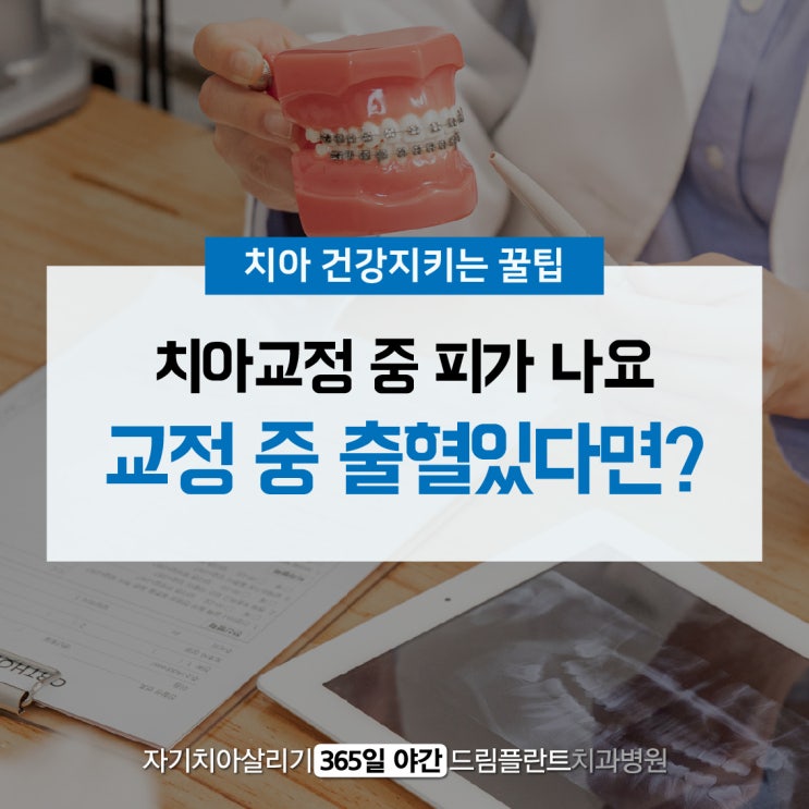 김해 교정치과와 알아보는 치아교정 중 출혈 대처법 교정 중 피날 때 칫솔질은 네이버 블로그