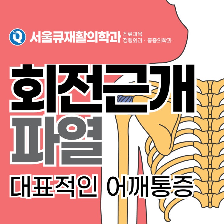 석촌동정형외과 대표적인 어깨통증 회전근개파열원인 네이버 블로그