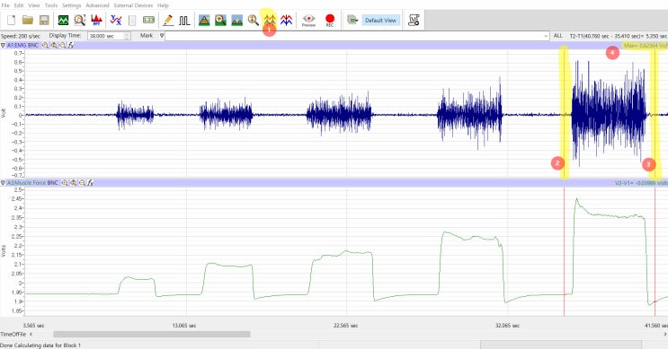 [#12]고투바이오 EMG : Normalizing to Maximum Voluntary Contraction (MVC) 근전도 ...