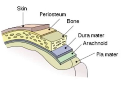 Burr hole trephination(천공배액술)과 Subdural drain 간호 : 네이버 블로그
