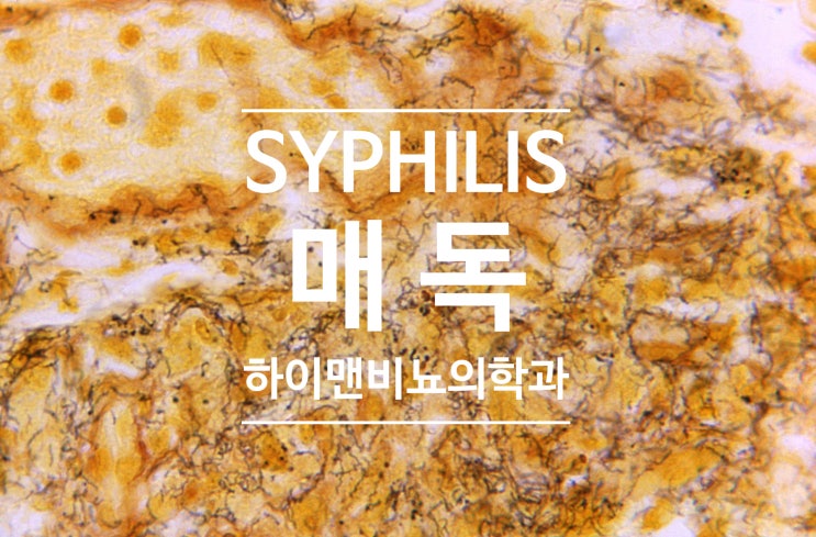 남자 여자 매독 증상과 사진 네이버 블로그