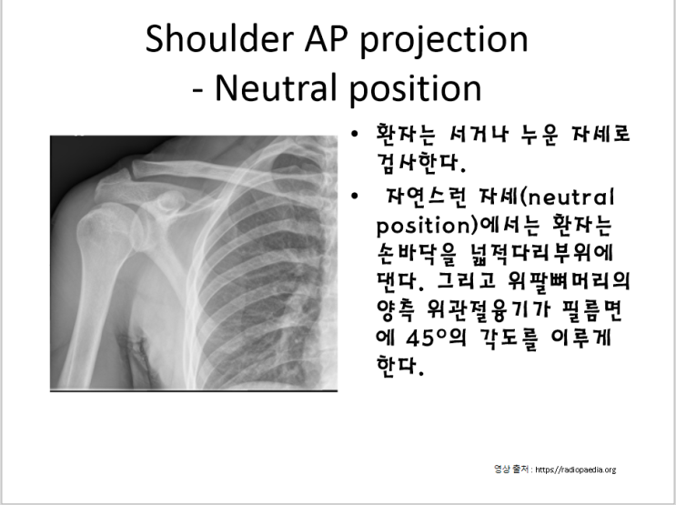 [일반촬영] 어깨 앞뒤 방향 촬영 - 자연스런자세 (Shoulder AP projection - Neutral position ...