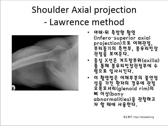 [일반촬영] 어깨 축방향 촬영 - Lawrence법(Soulder Axial projection - Lawrence method ...