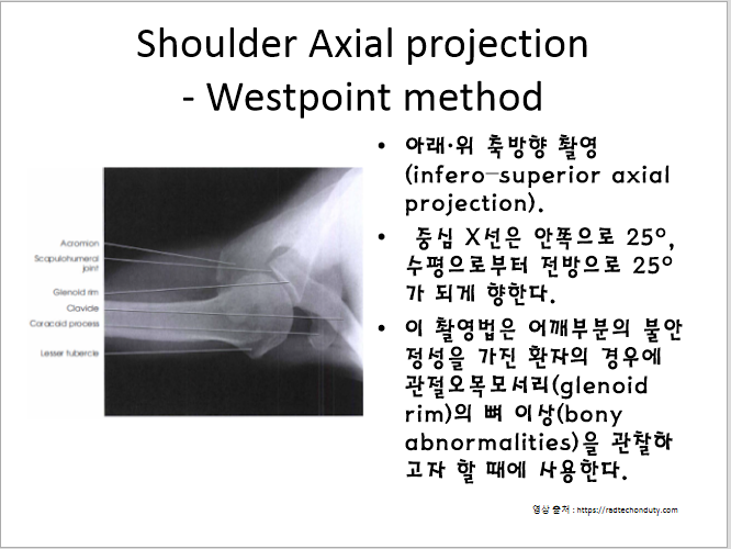 [일반촬영] 어깨 축방향 촬영 - Westpoint법(Soulder Axial projection - Westpoint ...