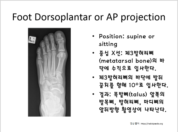 [일반촬영] 발 앞뒤방향 촬영 (Foot Dorsoplantar or AP projection) : 네이버 블로그