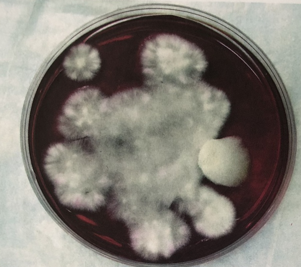 피부 사상균 검사 곰팡이 배지 배양 Dermatophyte Test Medium Fungal Cultures : 네이버 블로그