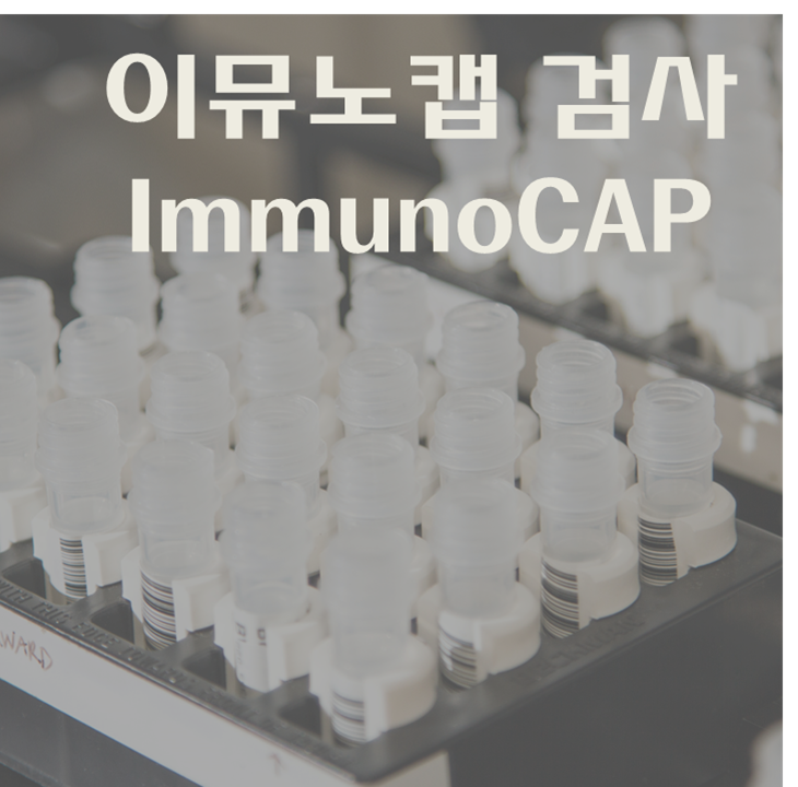 이뮤노캡(ImmunoCAP) 검사란? [알레르기 검사 방법] : 네이버 블로그