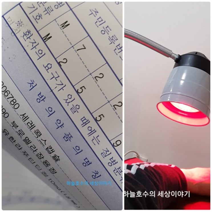발바닥 염증치료!근막성 섬유종증(족저근막염 m722) : 네이버 블로그