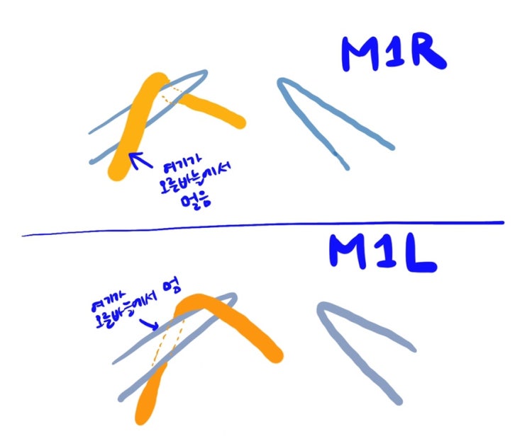 대바늘 - [자료] 코늘리기 / M1R, M1L : 네이버 블로그