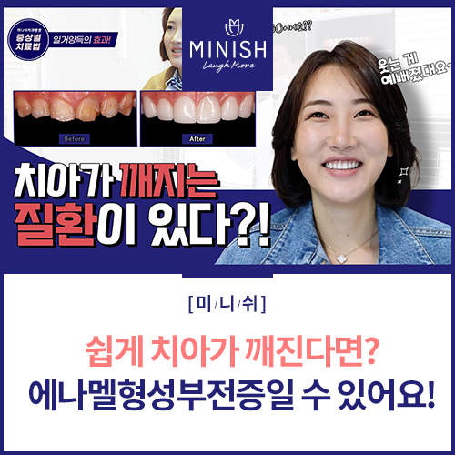 에나멜 법랑질 형성 부전증 깨진치아 앞니깨짐 깨진이빨 치료 네이버 블로그