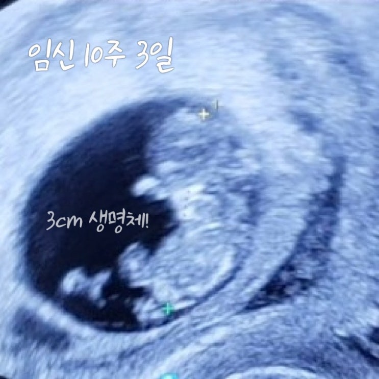 둘째맘이 겪은 임신 7주 8주 9주 10주 11주 증상절박유산 증상 절대안정 필요 입덧없음 네이버 블로그