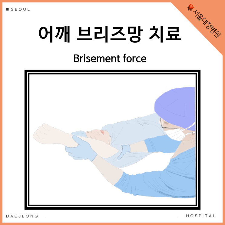 어깨 브리즈망 치료 (Brisement force)/천안 어깨 정형외과 전문의 : 네이버 블로그