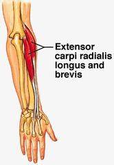 [대화역피티]신전근(extensor) 장/단요측수근신근(extensor carpi radialis longus and ...