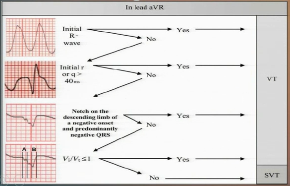 VT vs SVT abberancy : 네이버 블로그