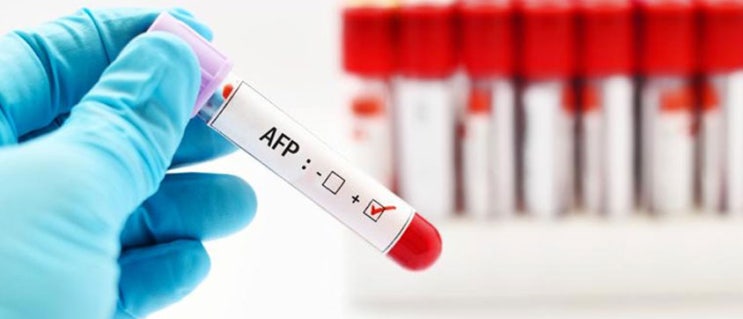 AFP 태아혈청단백 검사(Alpha-fetoprotein Test) : 네이버 블로그
