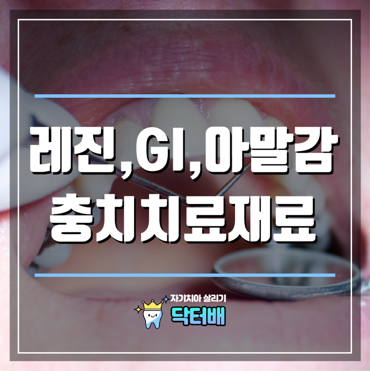충치치료비용 치과레진가격 이떼우는 치과수복재료 종류 I 아말감 레진 글래스아이오노머 네이버 블로그