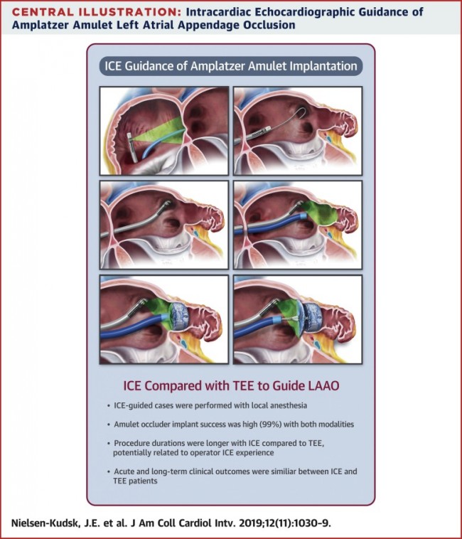 LAAO procedure : 네이버 블로그
