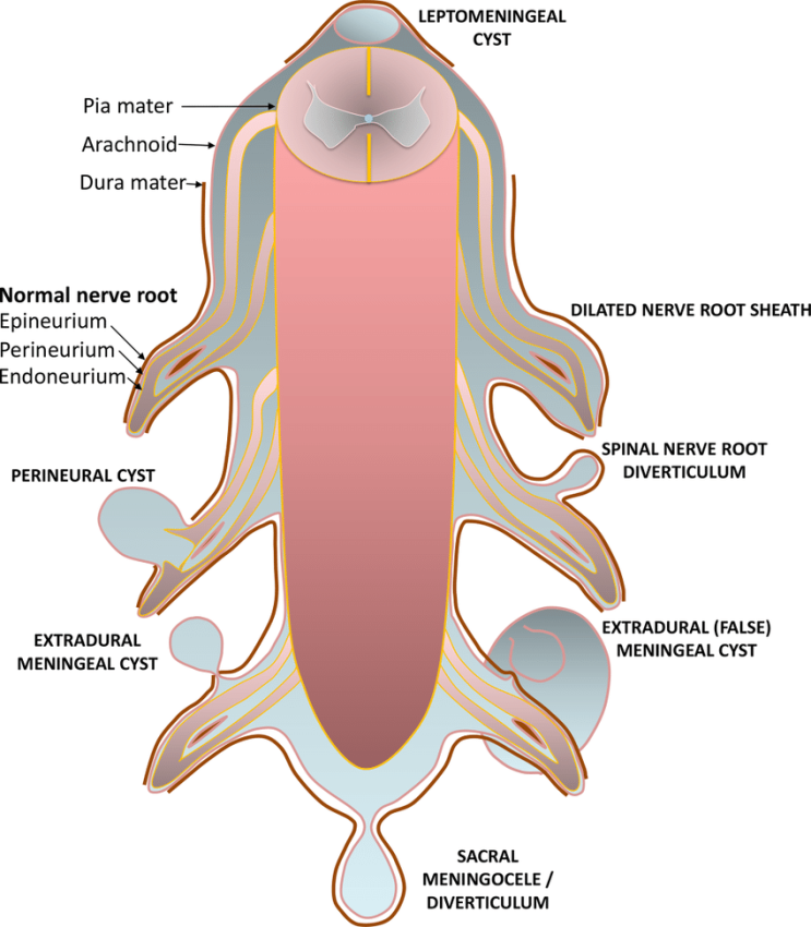 caudal epidural block 해부학 : 네이버 블로그
