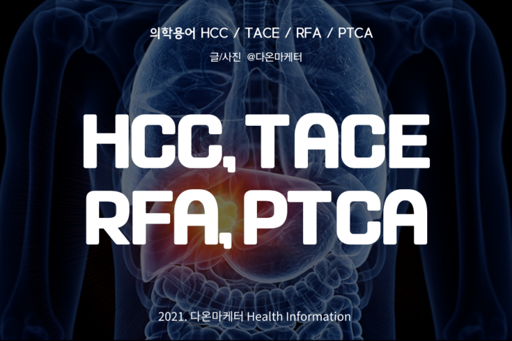 의학용어 HCC, TACE, RFA, PTCA 간, 심혈관계 필수용어 : 네이버 블로그