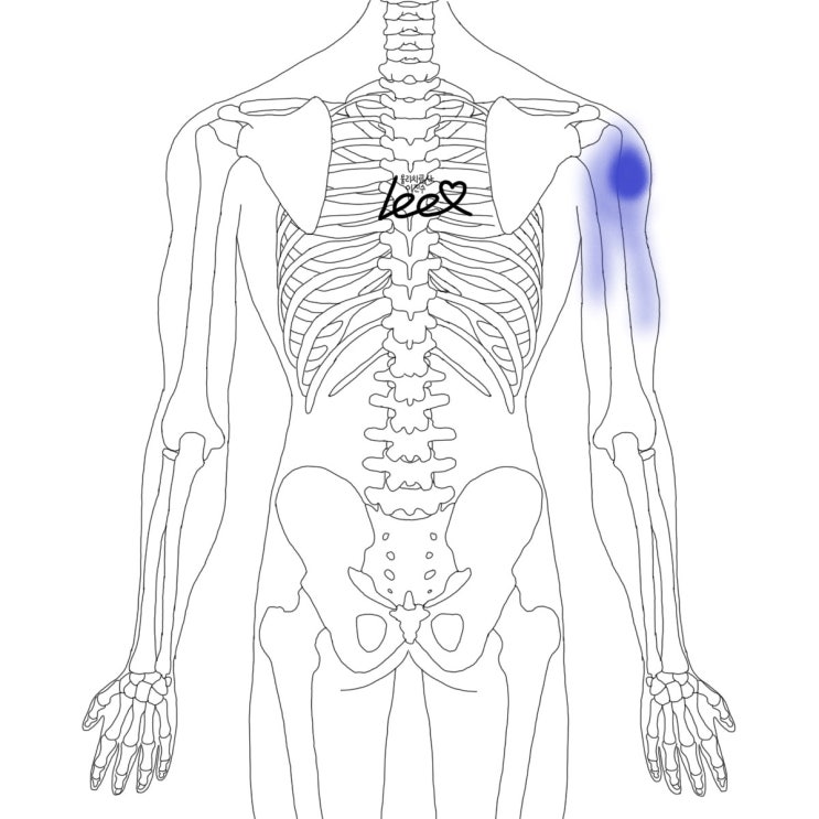 소원근(작은원근, Teres Minor) 통증유발점(Trigger point) : 네이버 블로그