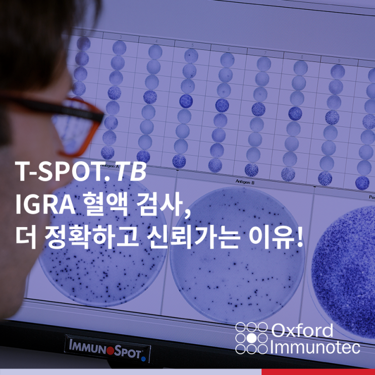 T-SPOT.TB IGRA 혈액 검사, 더 정확하고 신뢰가는 이유 : 네이버 블로그