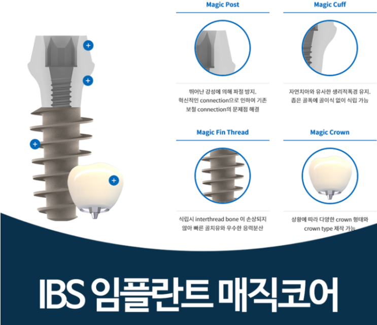 magic core를 이용한 발치 후 즉시 implant 식립 : 네이버 블로그