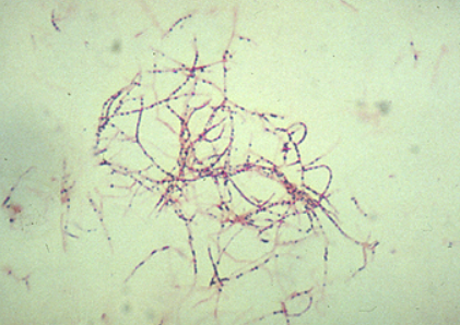 Nocardia, 미생물학과 진단 : 네이버 블로그