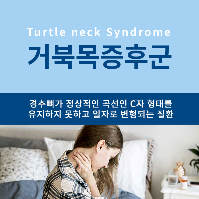 현대인의 고질병 '거북목 증후군'(Forward Head Posture, Turtle neck Syndrome) : 네이버 블로그