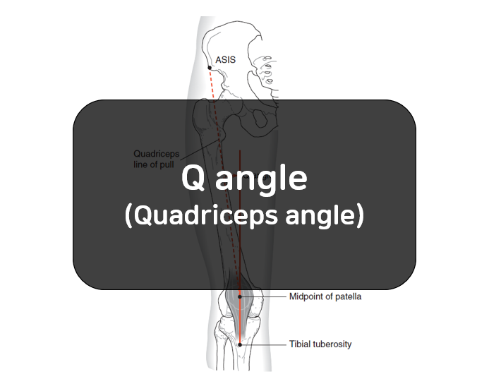 Q각(Q angle, Quadriceps angle)은 왜 생기고 어떻게 검사할까? : 네이버 블로그