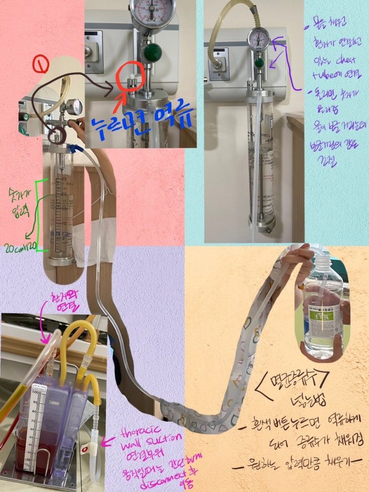 Thoracic wall suction : 네이버 블로그