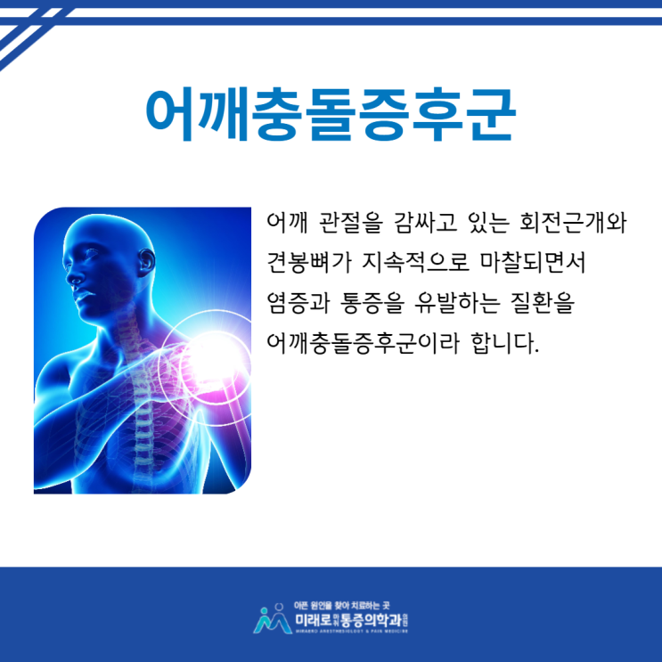은행동 정형외과 어깨에 지속적인 통증이 발생한다면 어깨충돌증후군 증상을 의심해봐야 합니다 네이버 블로그