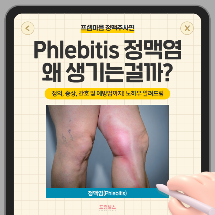 Phlebitis 정맥염 원인, 증상, 간호 및 예방법 : 네이버 블로그