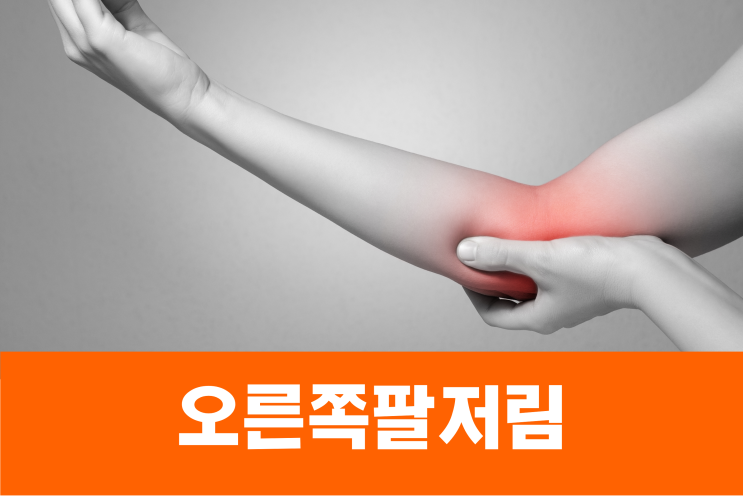 팔이 저린 이유 오른쪽 왼쪽 팔저림 원인 목에 있을 수도 네이버 블로그