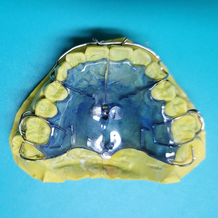 Fan type Expander : 네이버 블로그