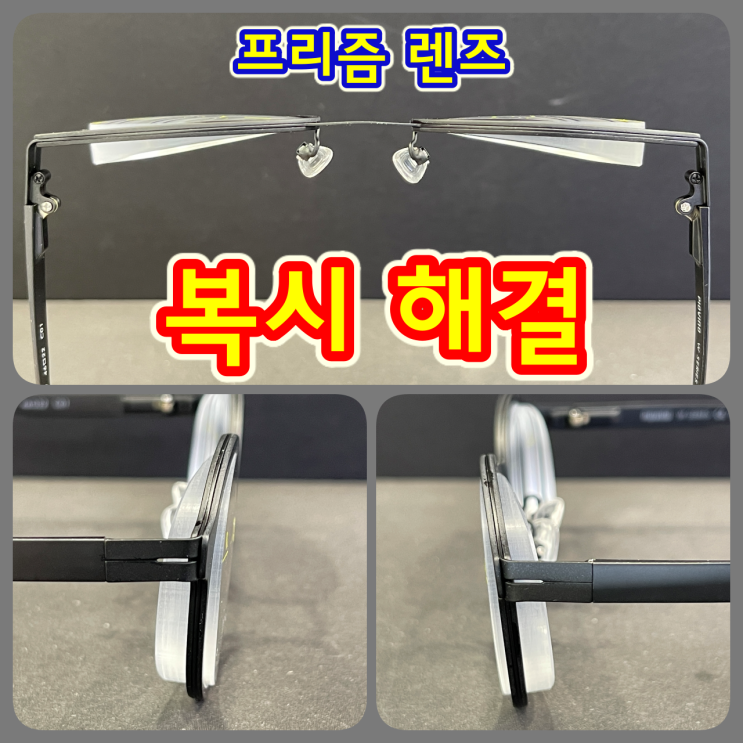 복시의 종류 복시 해결 프리즘 안경 렌즈의 특성ㄴㄱㅇㅎ 네이버 블로그
