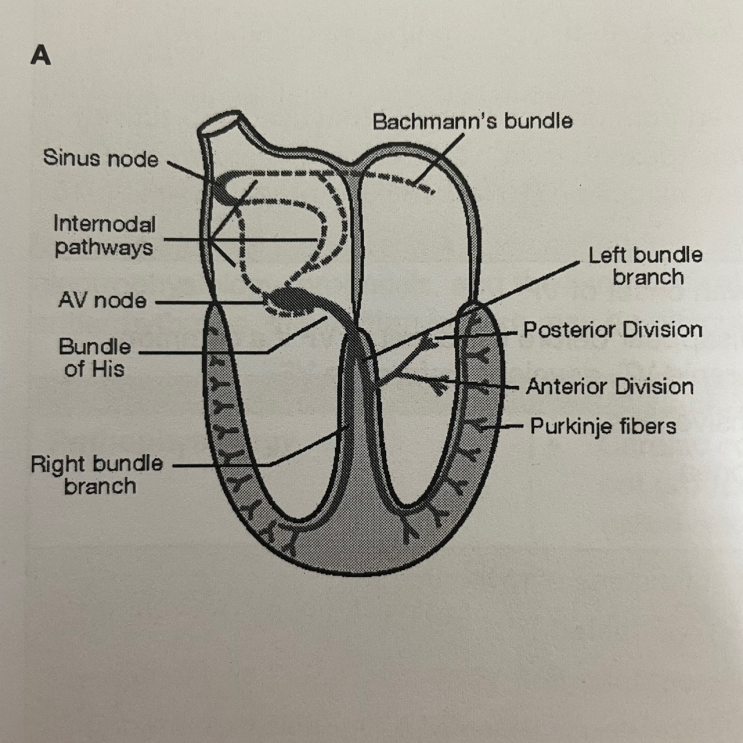 ACLS provider 알아야할 지식(3)_ ECG, ACLS Core Rhythms, 부정맥, Arrest : 네이버 블로그
