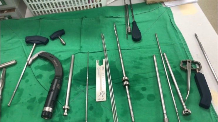 PFN: Long Gamma Nail : 네이버 블로그