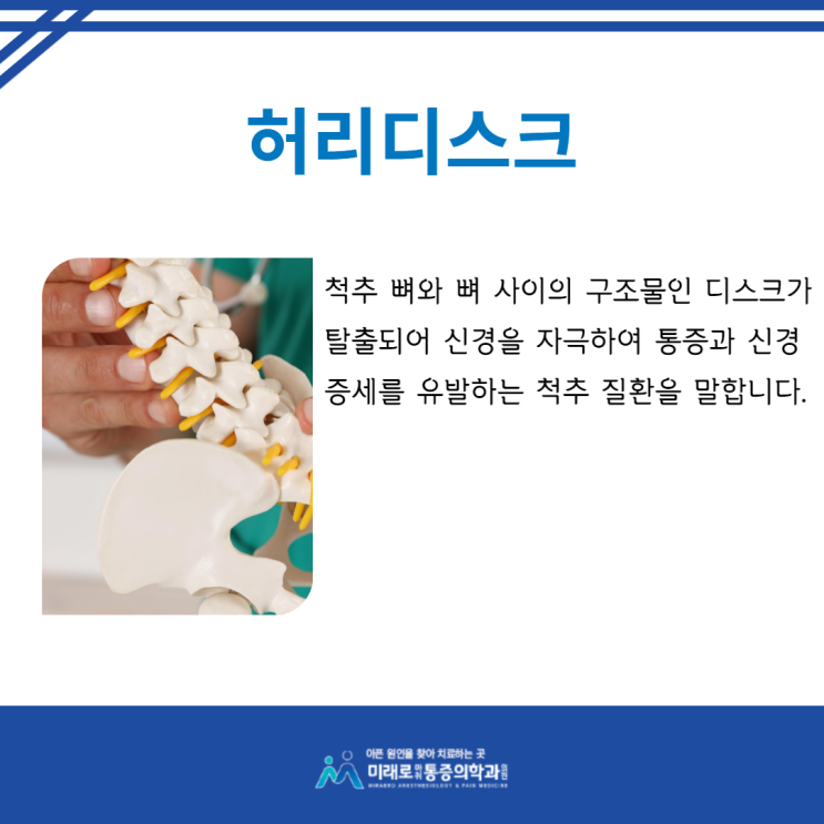 양지동 진료과목 신경과 허리와 엉치 부위 통증 지속 허리디스크 증상일 수 있습니다 네이버 블로그