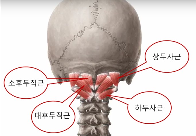 필라테스 숲 목 어깨의 긴장두통의 원인 후두하근 네이버 블로그