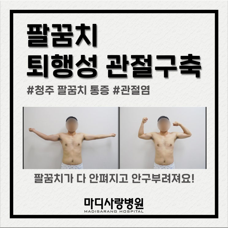 청주팔꿈치관절염 퇴행성관절구축 의심해 보세요 네이버 블로그